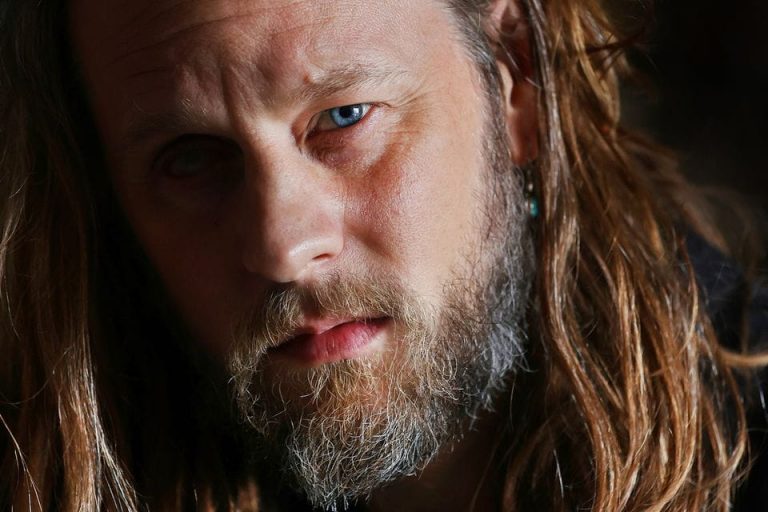 Famous People with One Eye: 15 Lives That Inspire