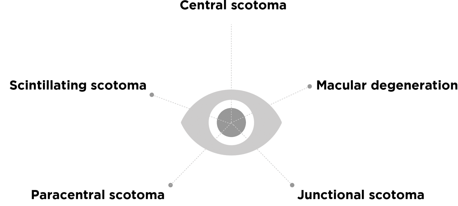 Why Do People Have a Blind Spot in Vision?