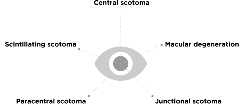 Why Do People Have a Blind Spot in Vision?