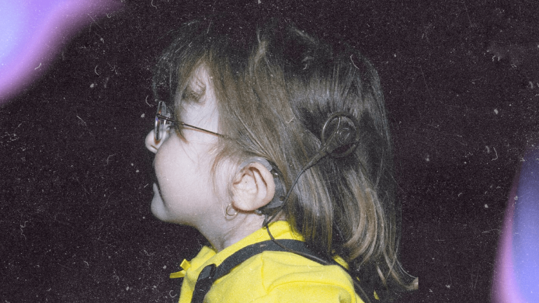 CHARGE Syndrome: What Is It?